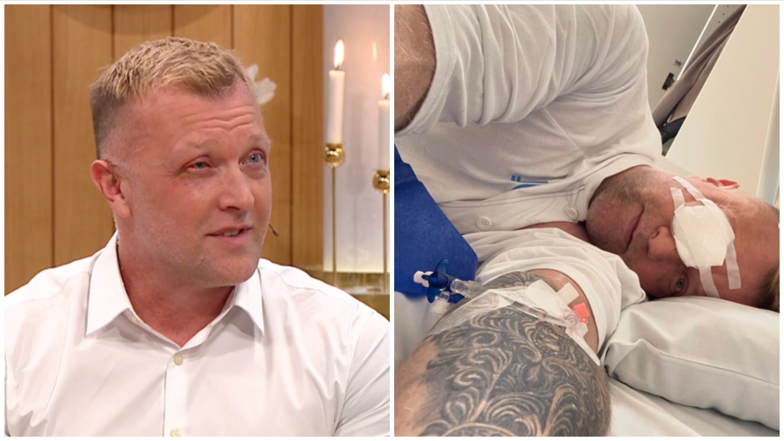 Hedmans skräckskada: Hade två stora hål i ögat | nu.se